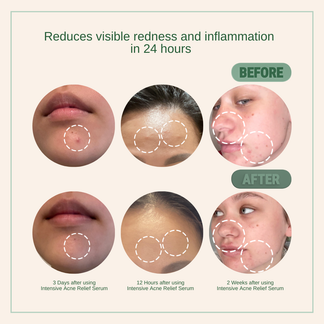 Radiance Reimagined: Clear & Glow Skincare Set – SkinSupp Co.